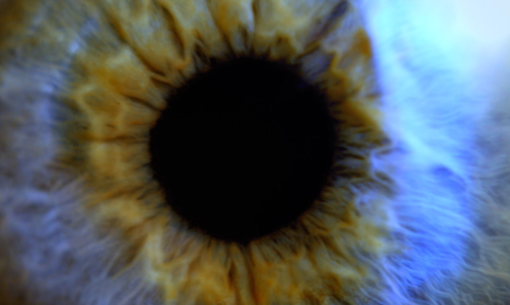 Monofocal IOLs | Intraocular Lenses | Spectrum Ophthalmics