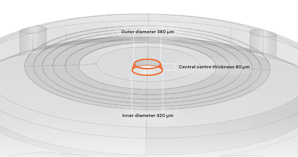 IPCL V2 | Implantable Phakic Contact Lens Implants | Spectrum
