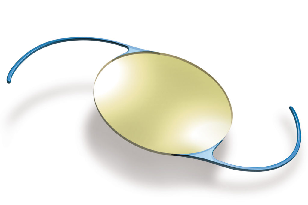 Cataract IOLs | Intraocular Lenses | Spectrum Ophthalmics